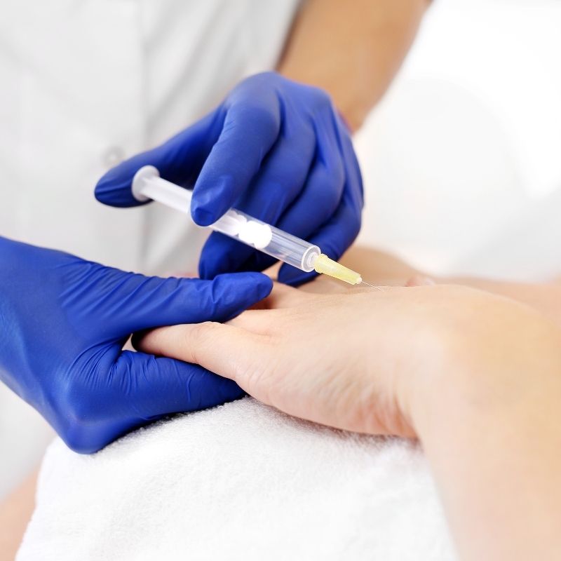 Hand Mesotherapy